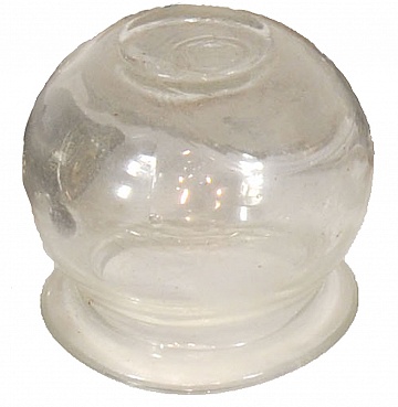 Bleeding and Cupping :: MoHMA