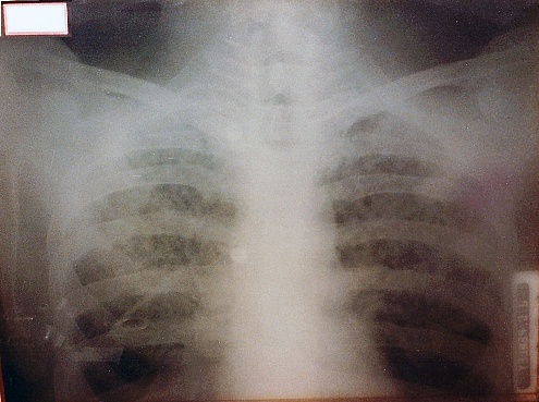Radiology :: MoHMA