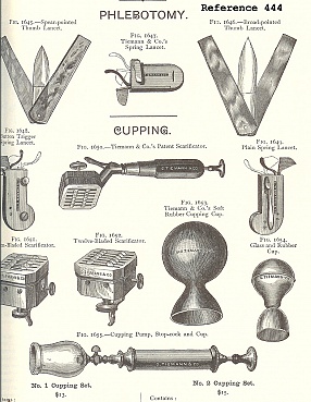 Bleeding and Cupping :: MoHMA